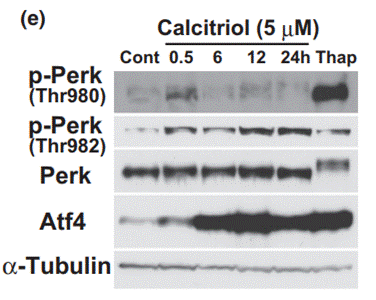 Calcitriol | 骨化三醇 | 购买0 激动剂 - Selleck