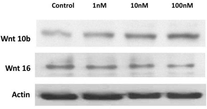 Calcitriol | 骨化三醇 | 购买0 激动剂 - Selleck