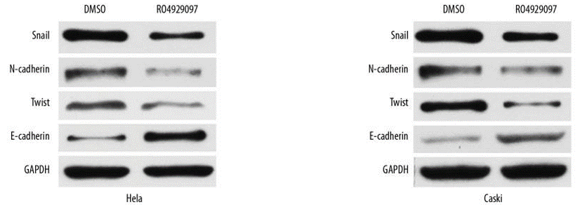 RO4929097 (RG-4733) | 购买Secretase 抑制剂 - Selleck