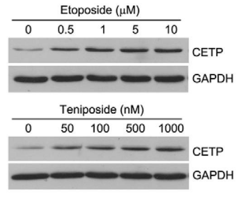 购买Teniposide | Topoisomerase inhibitor | 价格 | IC50 | 只能用于研究