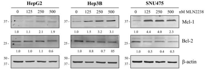 Ixazomib Citrate (MLN9708) | 购买Proteasome 抑制剂 - Selleck