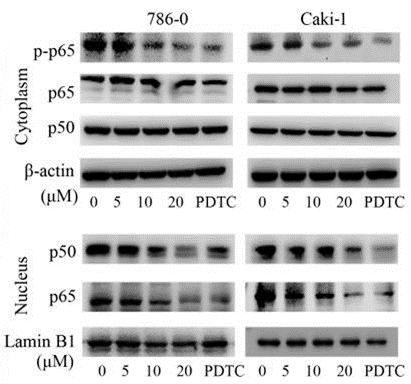 Pyrrolidinedithiocarbamate ammonium | NF-κB 抑制剂 | 现货供应 | 美国品牌 | 免费采购电话 ...