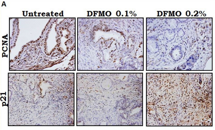 Eflornithine (DFMO) hydrochloride hydrate | 依氟鸟氨酸盐酸盐一水合物 ...