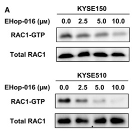 EHop-016 | 购买Rho 抑制剂 - Selleck