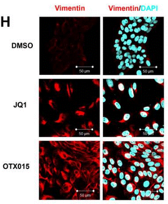 Birabresib (OTX015) | 比拉瑞塞 | 购买Epigenetic Reader Domain 抑制剂 - Selleck