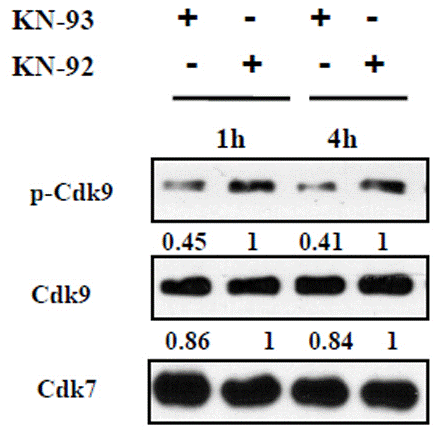 KN-93 Phosphate | CaMK 抑制剂 | 现货供应 | 美国品牌 | 免费采购电话400-668-6834
