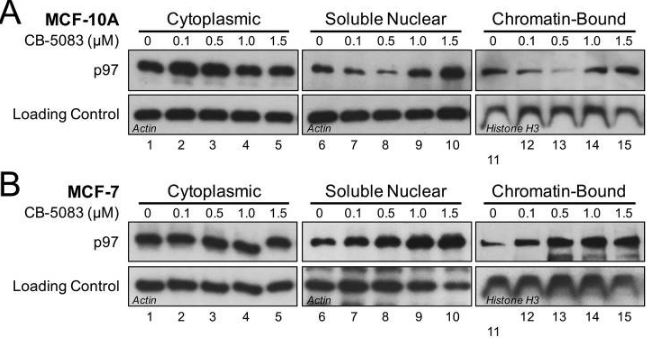 CB-5083 | ATPase 抑制剂 | 现货供应 | 美国品牌 | 免费采购电话400-668-6834
