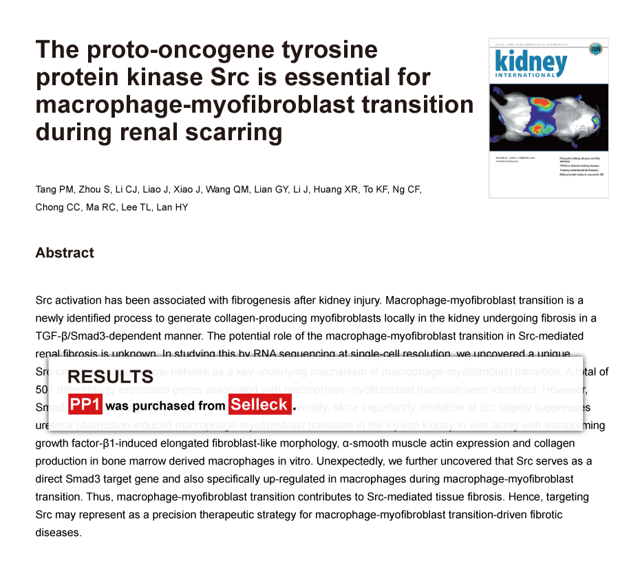 PP1 | Src 抑制剂 | 现货供应 | 美国品牌 | 免费采购电话400-668-6834
