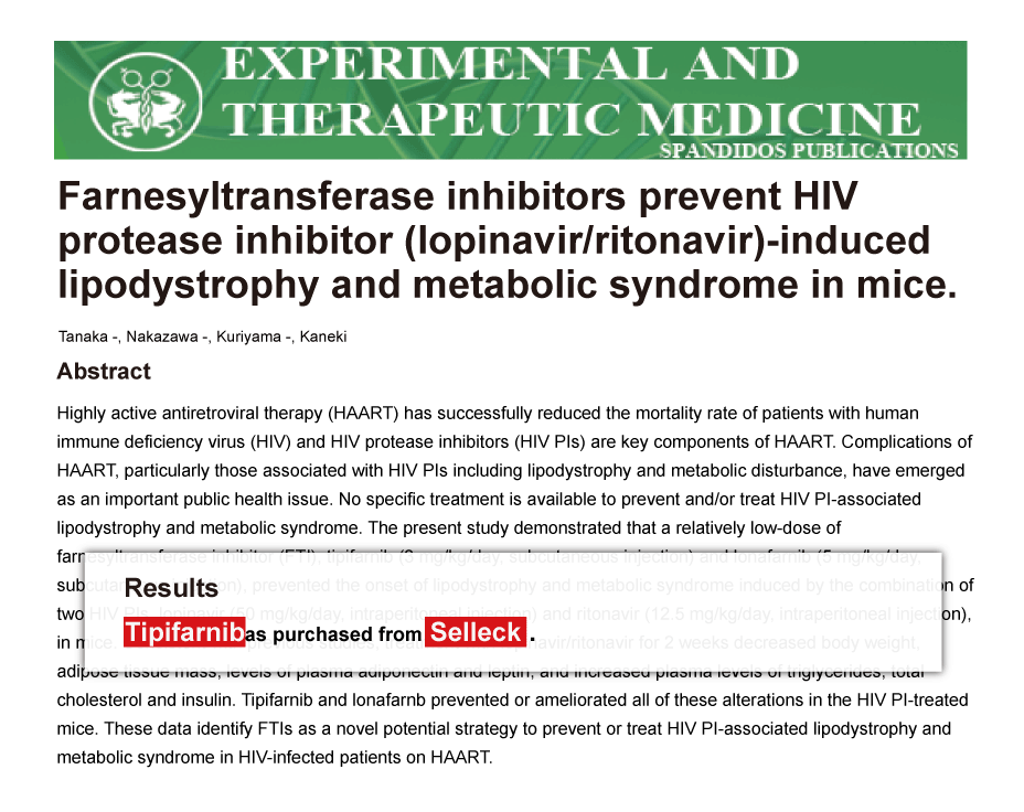 Tipifarnib (R115777) | 购买FTase 抑制剂 - Selleck