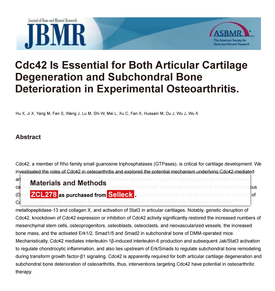Rho抑制剂 | Rho Inhibitor