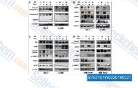 Afuresertib (GSK2110183) | Akt 抑制剂 | 现货供应 | 美国品牌 | 免费采购电话400-668-6834