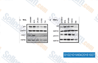 Src抑制剂 | Src Inhibitor