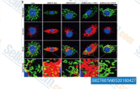 FCCP | ATPase 抑制剂 | 现货供应 | 美国品牌 | 免费采购电话400-668-6834
