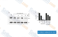 Smoothened抑制剂 | Smoothened Inhibitor