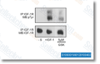 IGF-1R抑制剂 | IGF-1R Inhibitor