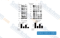 NF-κB抑制剂 | NF-κB Inhibitor