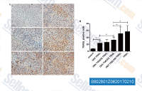 Tariquidar | 购买P-gp 抑制剂 - Selleck