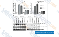 Tideglusib | 购买GSK-3 抑制剂 - Selleck