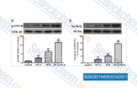 Tideglusib | 购买GSK-3 抑制剂 - Selleck