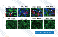 Tideglusib | 购买GSK-3 抑制剂 - Selleck
