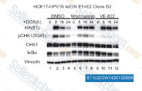 Berzosertib (VE-822|VX970|M6620) | 购买ATM/ATR 抑制剂 - Selleck