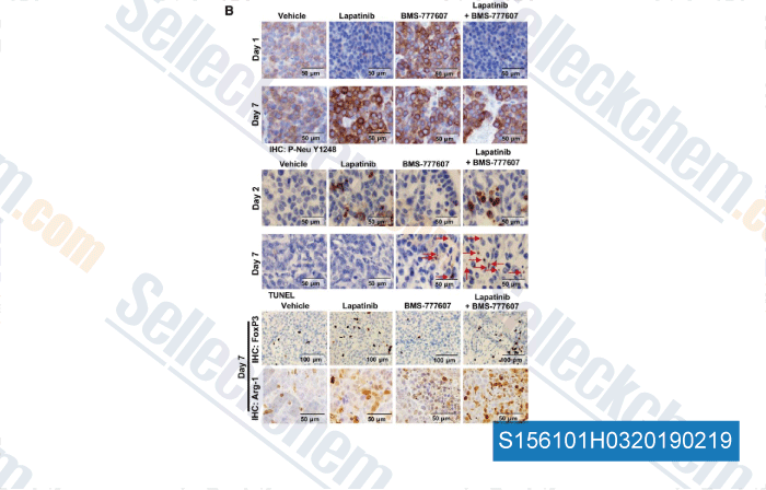 c-Met抑制剂 | c-Met Inhibitor
