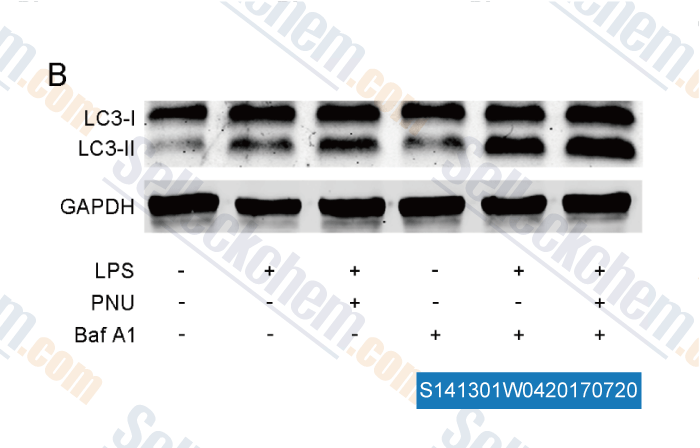 Bafilomycin A1(Baf-A1) | Proton Pump 抑制剂 | 现货供应 | 美国品牌 | 免费采购电话400-668-6834